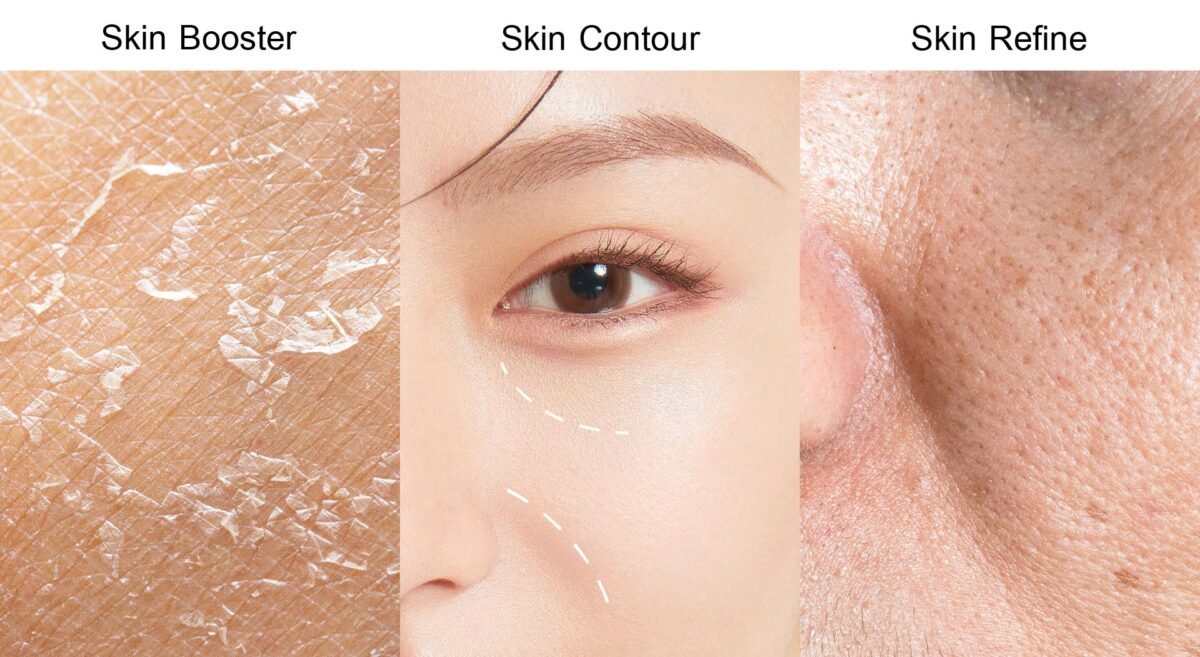 Skin Booster Program EN – Hertitude Clinic